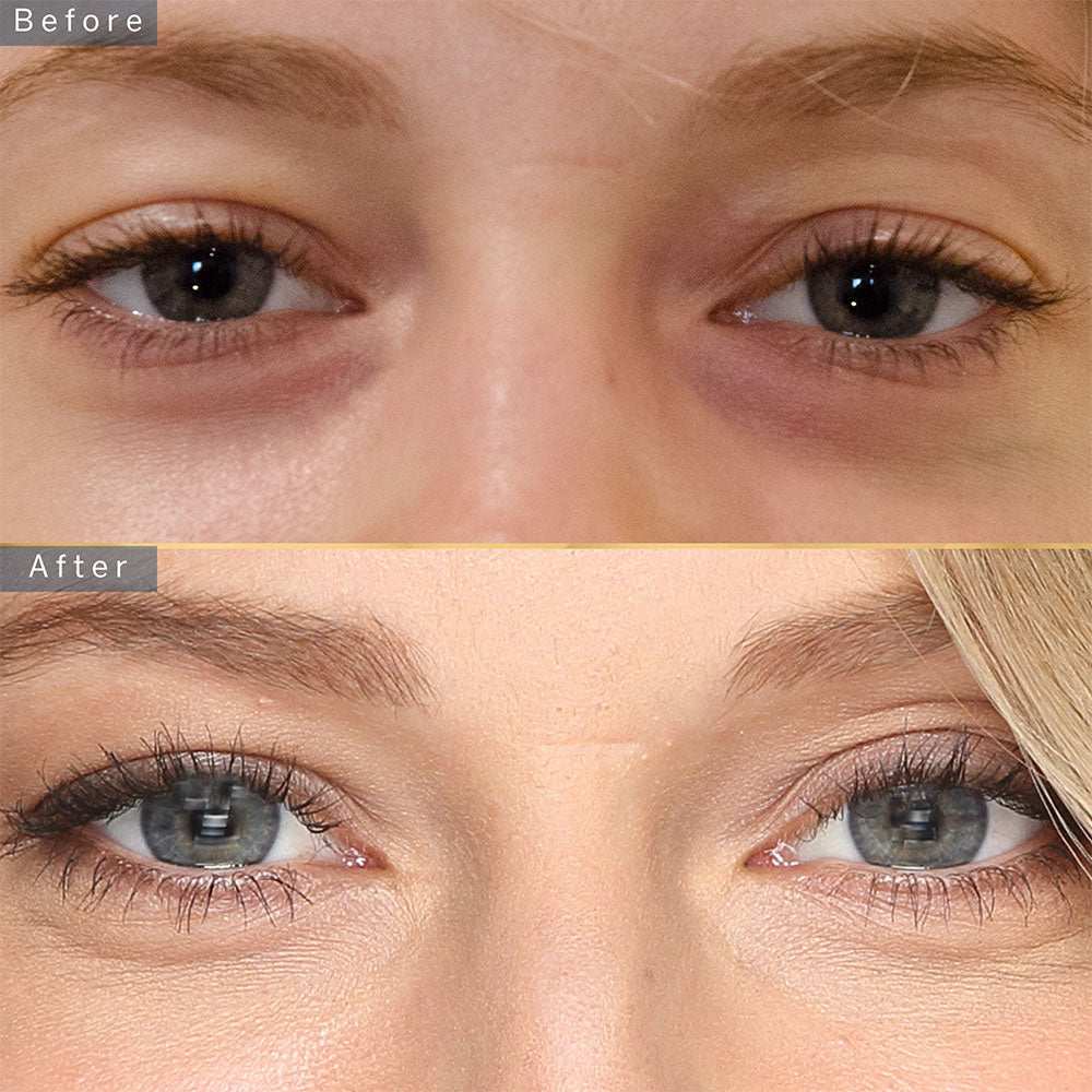 CoverAge Concealer Stick– Jerome Alexander